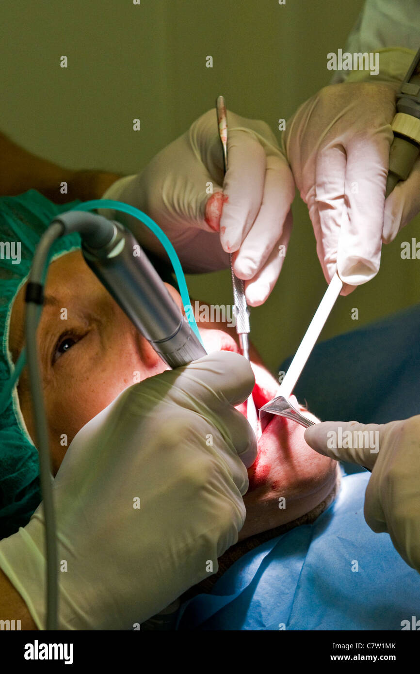 Patient receiving dental treatment Stock Photo - Alamy