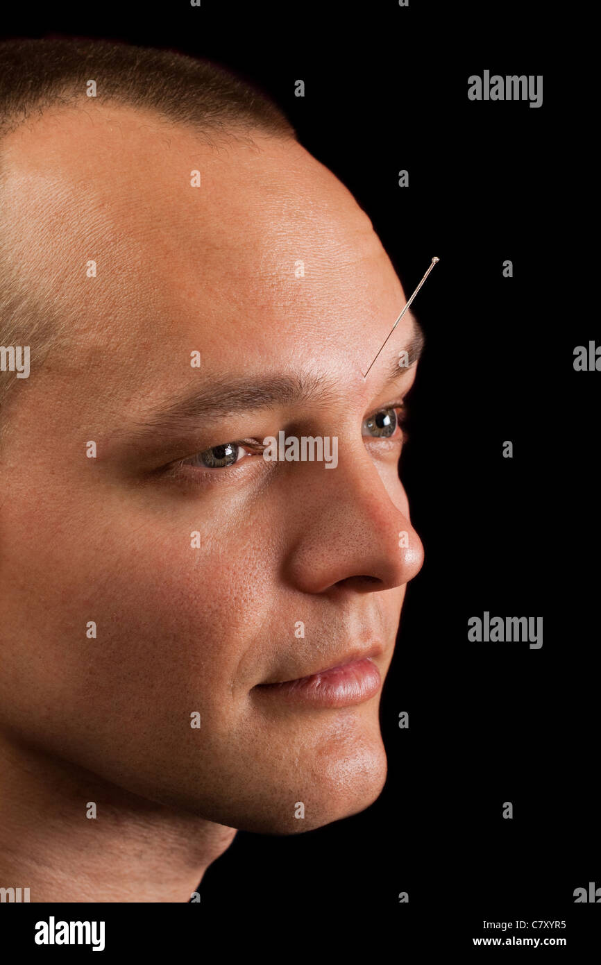Acupuncture points head hi-res stock photography and images - Alamy