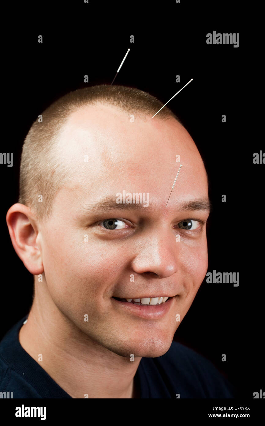 Man receiving cranial acupuncture, looking at camera Stock Photo - Alamy