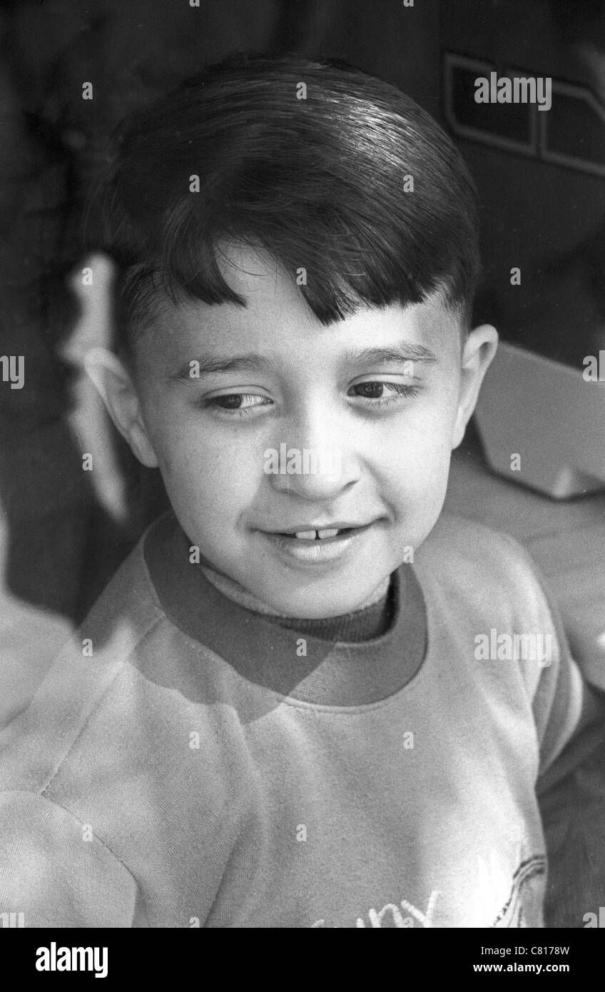 Smile reconstruction hi-res stock photography and images - Alamy