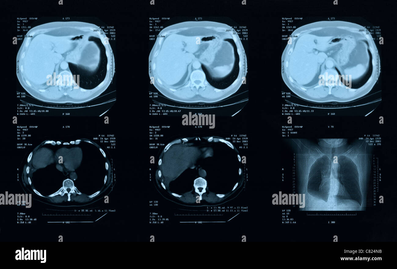 Multiply the magnetic resonance images of the human body Stock Photo ...