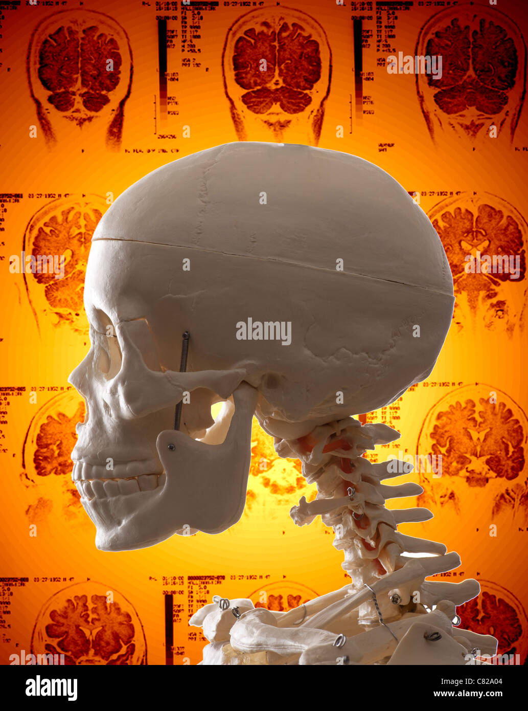 concept image human skull and MRI background Stock Photo - Alamy