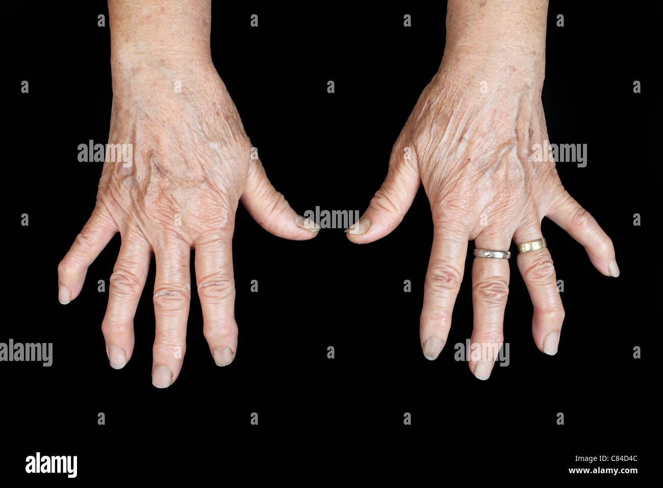 Closeup shot of open palms of old woman Stock Photo - Alamy