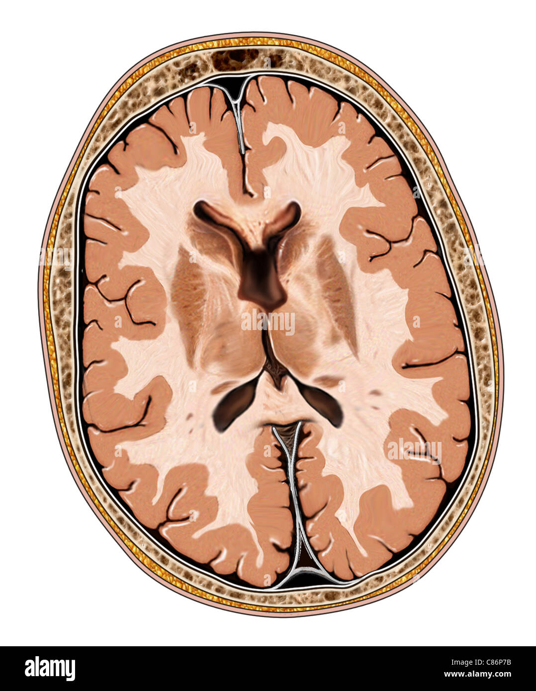 Axial View Of Brain