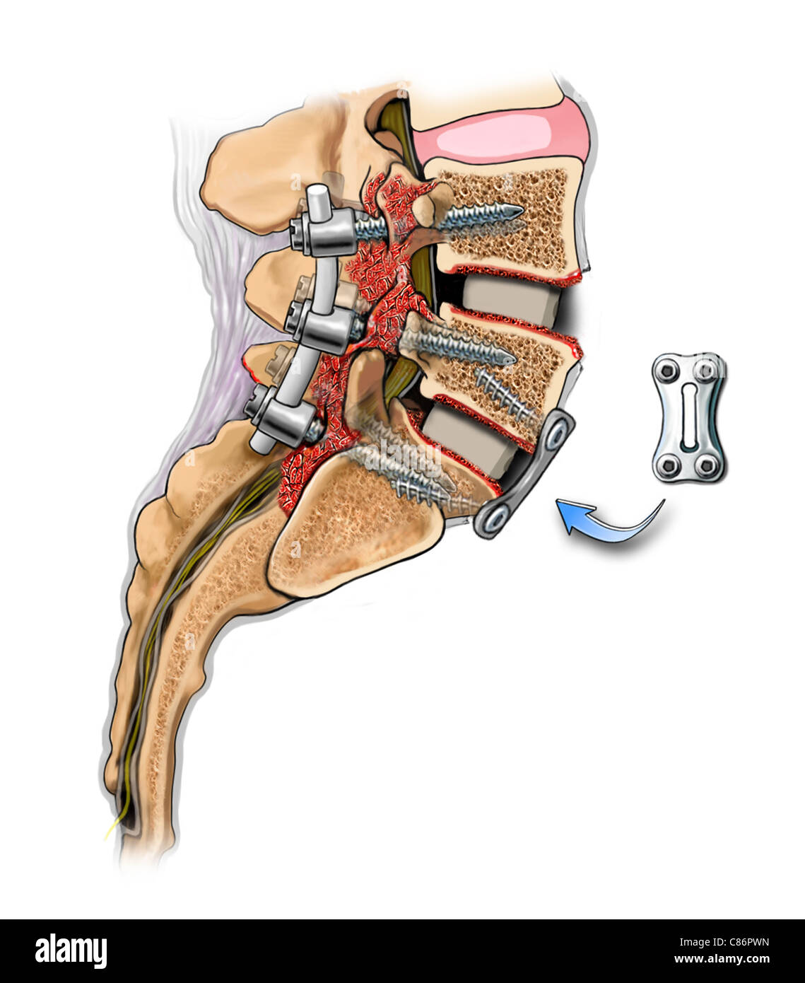 L4 s1 hi-res stock photography and images - Alamy