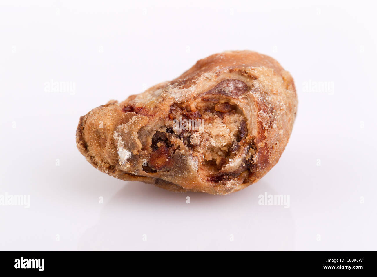 Kidney stone hi-res stock photography and images - Alamy