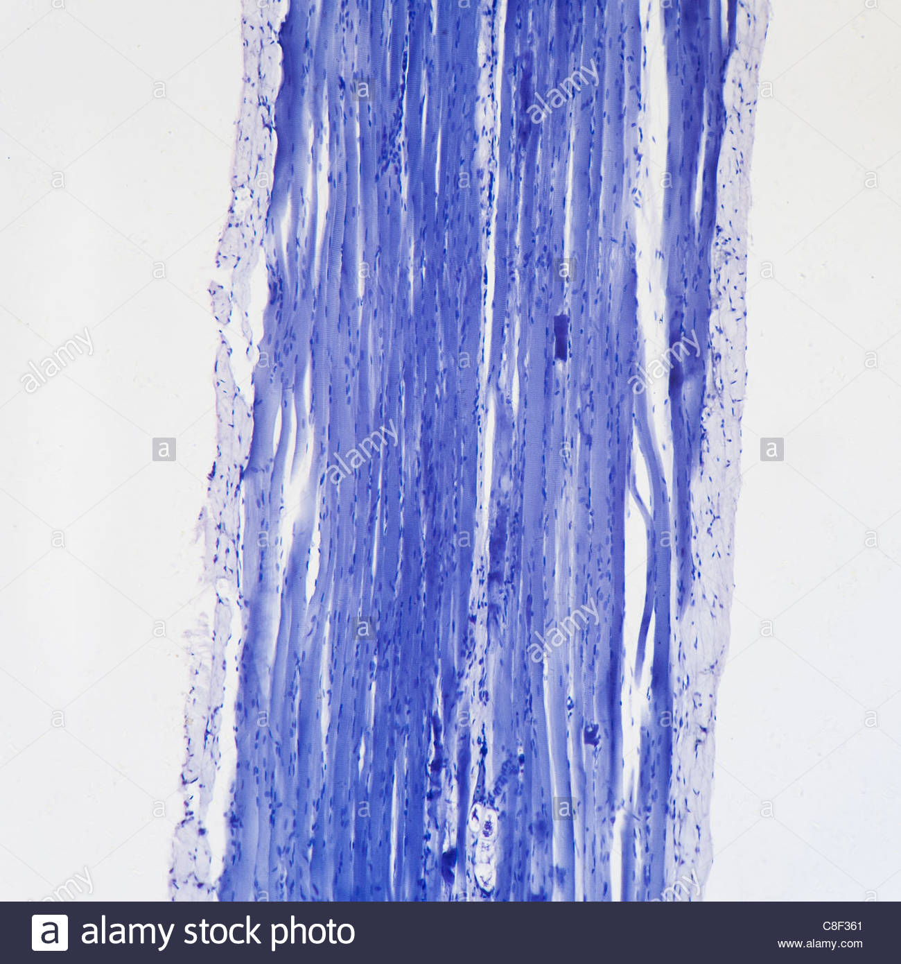 Muscle Tissue Micrograph High Resolution Stock Photography and Images ...