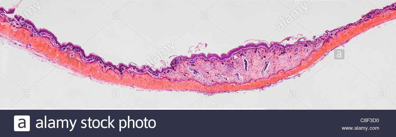 Microscopic Skin Stock Photos & Microscopic Skin Stock Images - Alamy