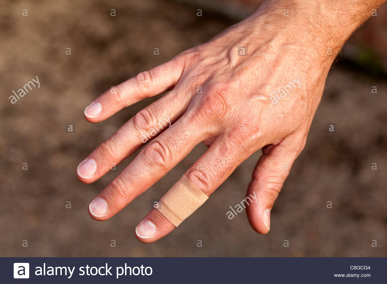 Finger Plaster Stock Photos & Finger Plaster Stock Images - Alamy