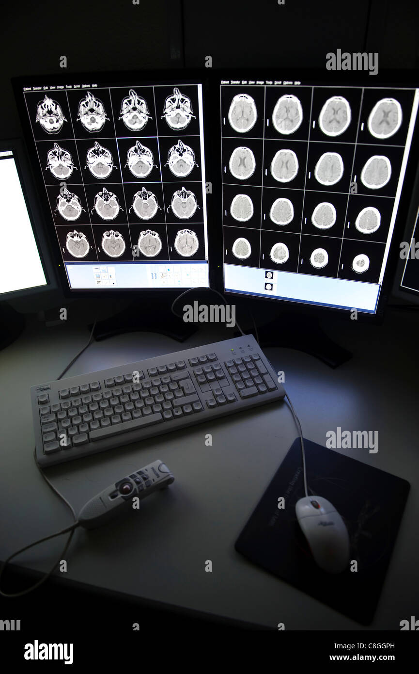 Ct scan brain hi-res stock photography and images - Alamy