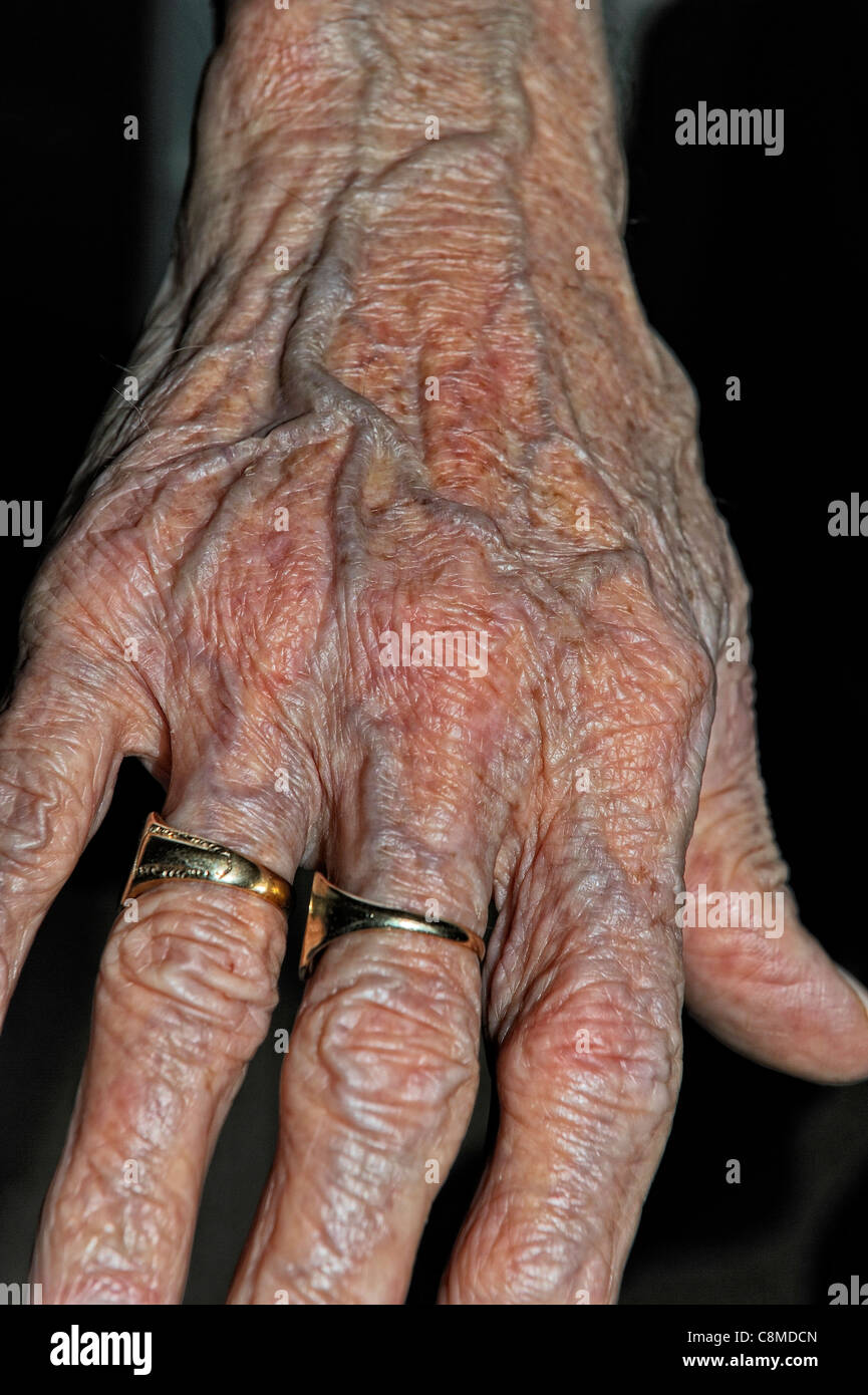 wrinkled hands of an 82 year old male england uk Stock Photo - Alamy