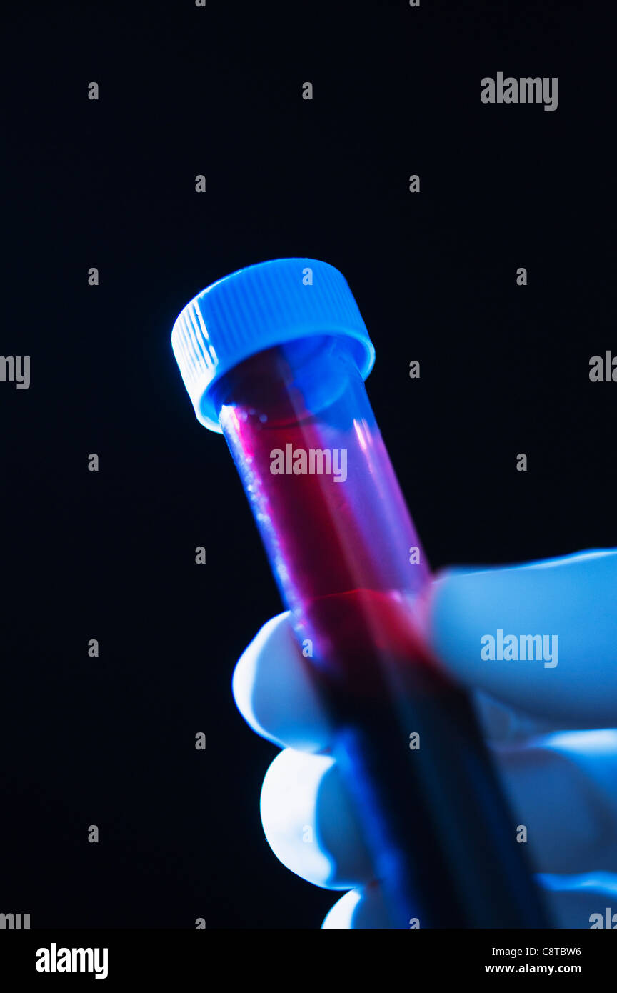 One blood vial hi-res stock photography and images - Alamy