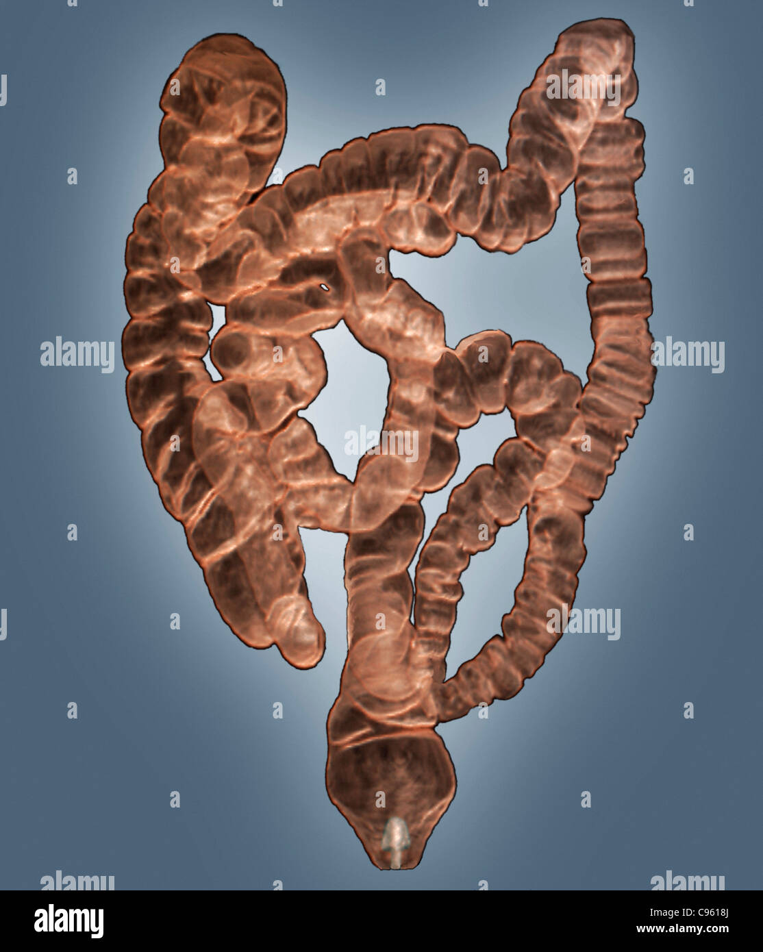 Normal intestines. Coloured 3D computed tomography (CT) scan of the ...