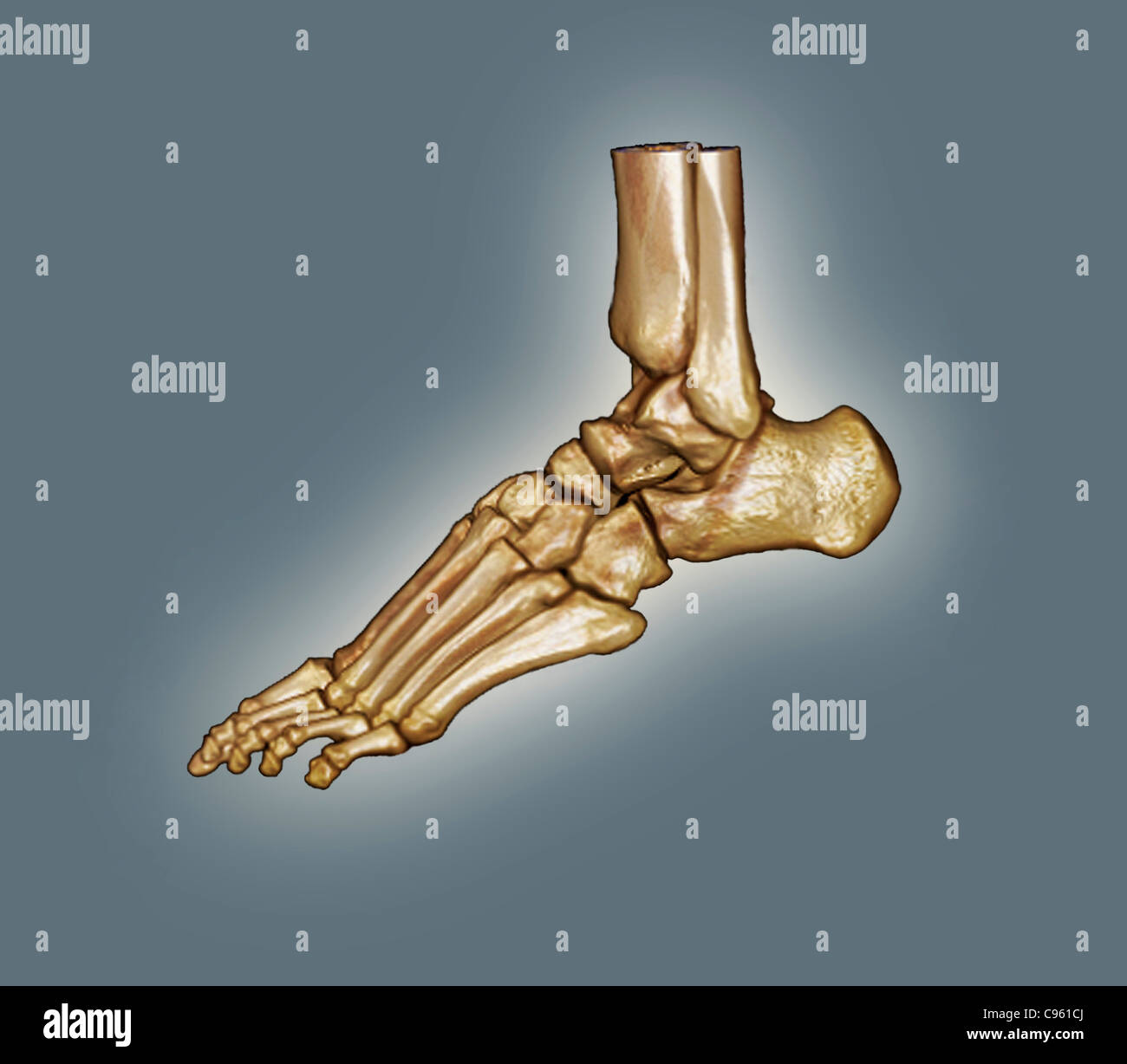 Normal foot. Coloured 3D computed tomography (CT) scan of the healthy ...