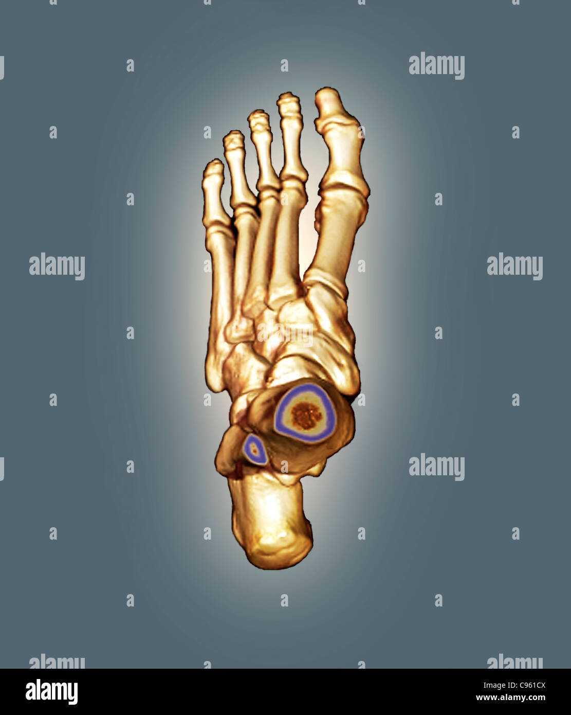 Ct scan leg hi-res stock photography and images - Alamy