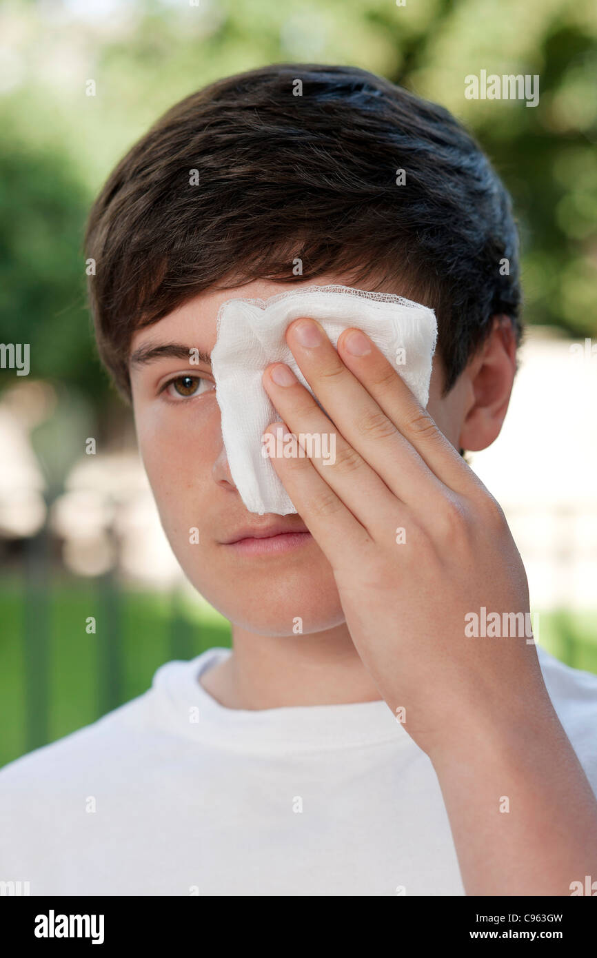 Eye Injury Stock Photos & Eye Injury Stock Images - Alamy