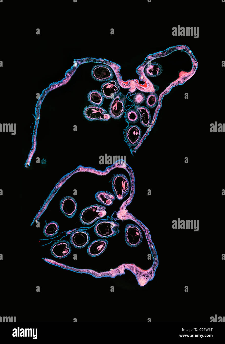 Shepherds Purse, Capsella, embryos seen through a microscope Stock ...