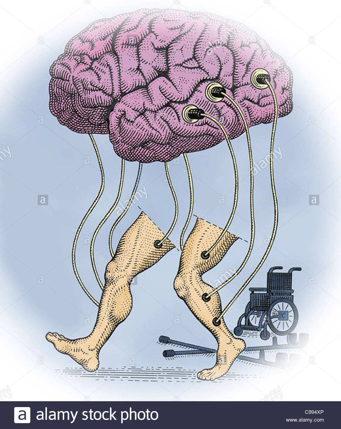 Neuroprosthesis Stock Photo, Royalty Free Image: 40154094 - Alamy