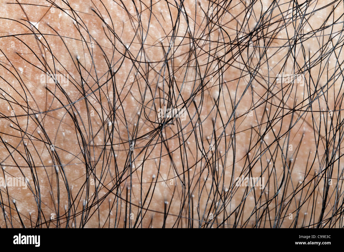 Human skin macro hair hi-res stock photography and images - Alamy
