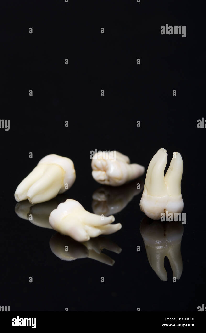 Wisdom tooth hi-res stock photography and images - Alamy