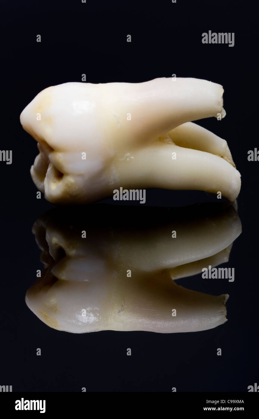 Wisdom tooth on black background, close up Stock Photo - Alamy