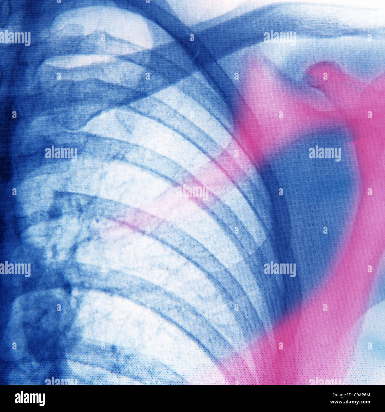 x-ray chest of human bone Stock Photo - Alamy