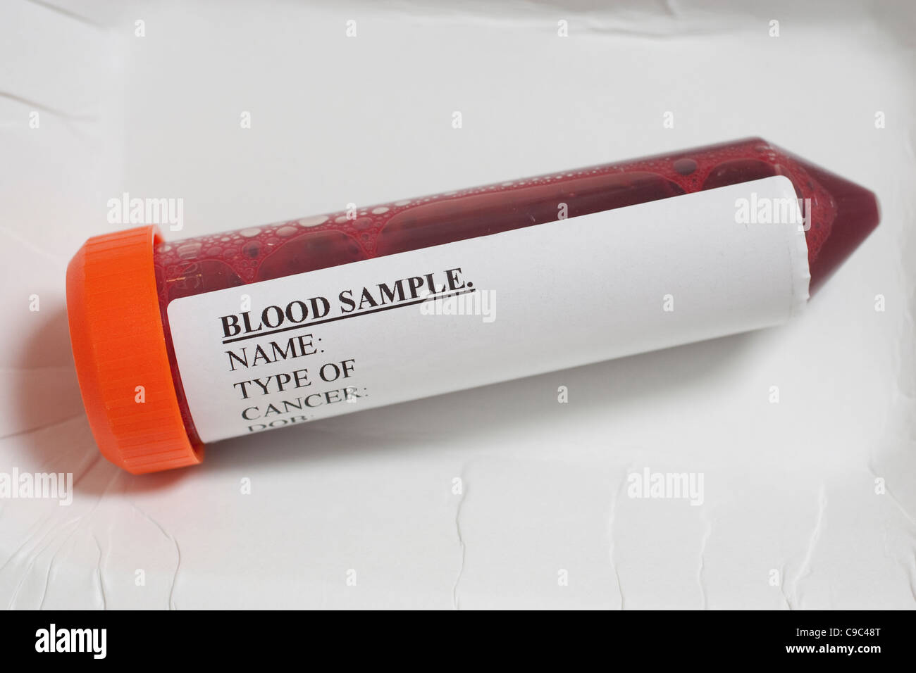 Blood sample capsules. Photo:Jeff Gilbert Stock Photo - Alamy