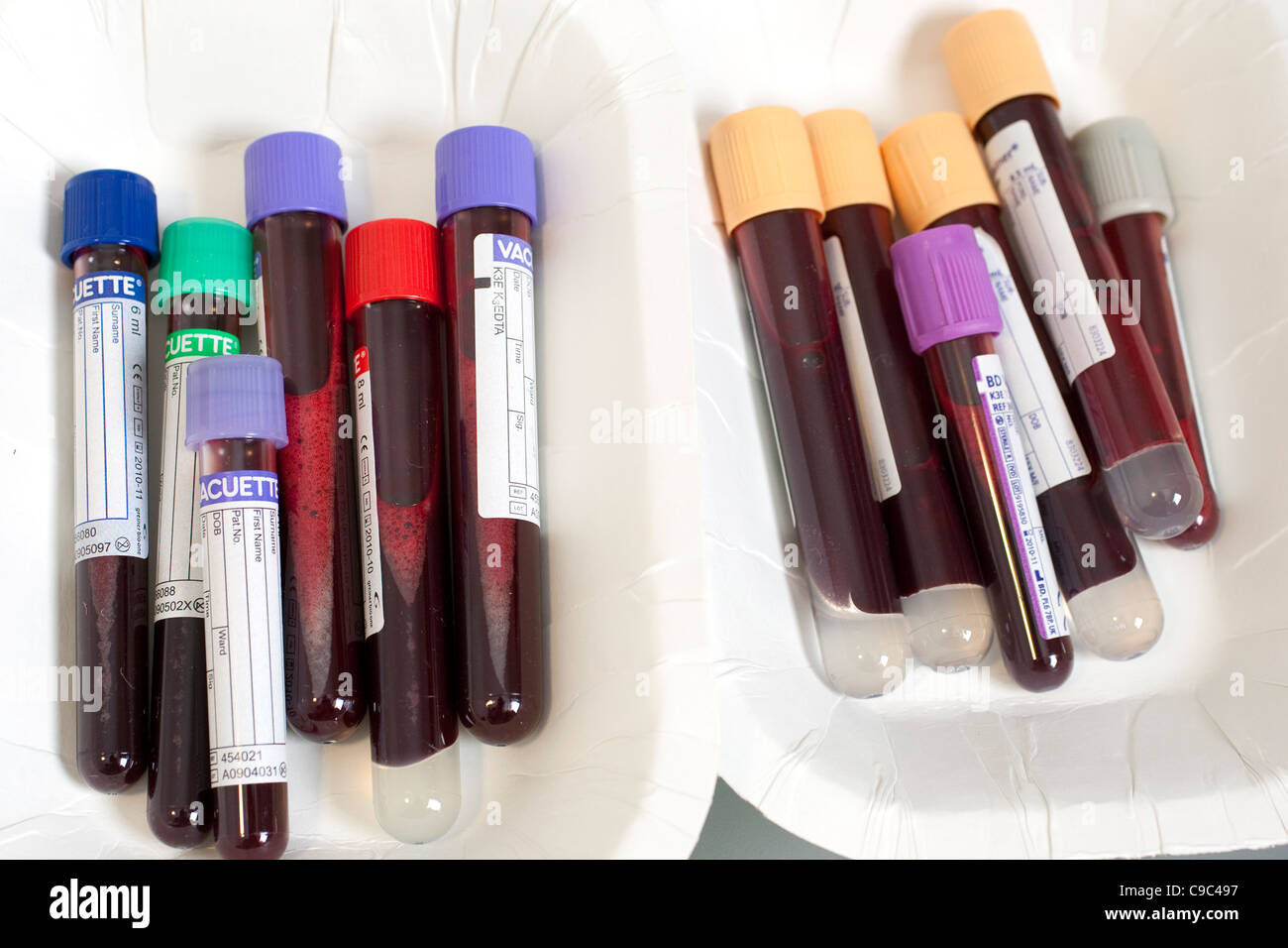 Blood sample capsules. Photo:Jeff Gilbert Stock Photo - Alamy