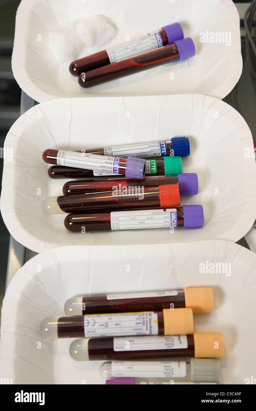 Blood sample capsules. Photo:Jeff Gilbert Stock Photo - Alamy