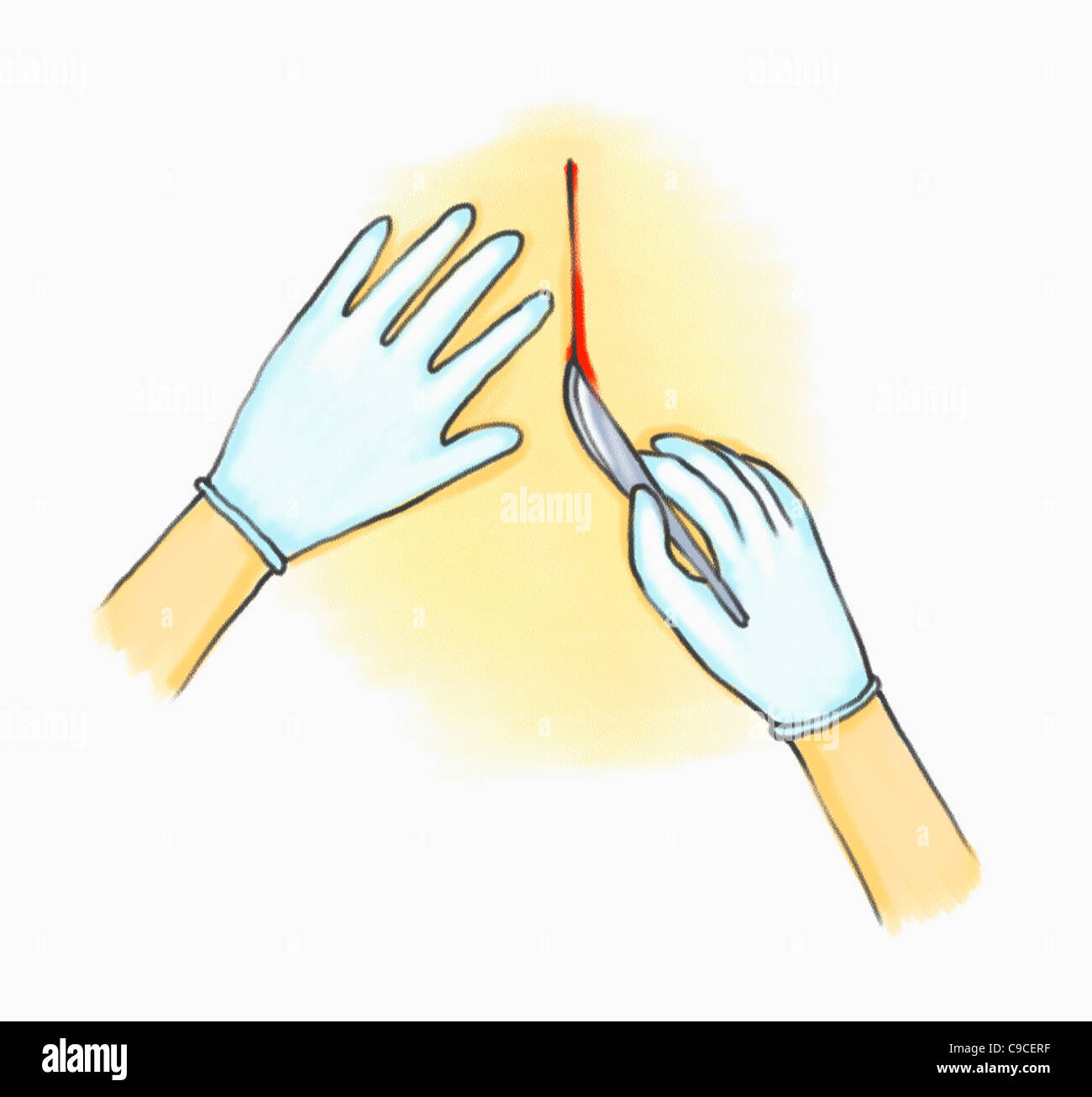 Instrument for cutting skin Cut Out Stock Images & Pictures - Alamy