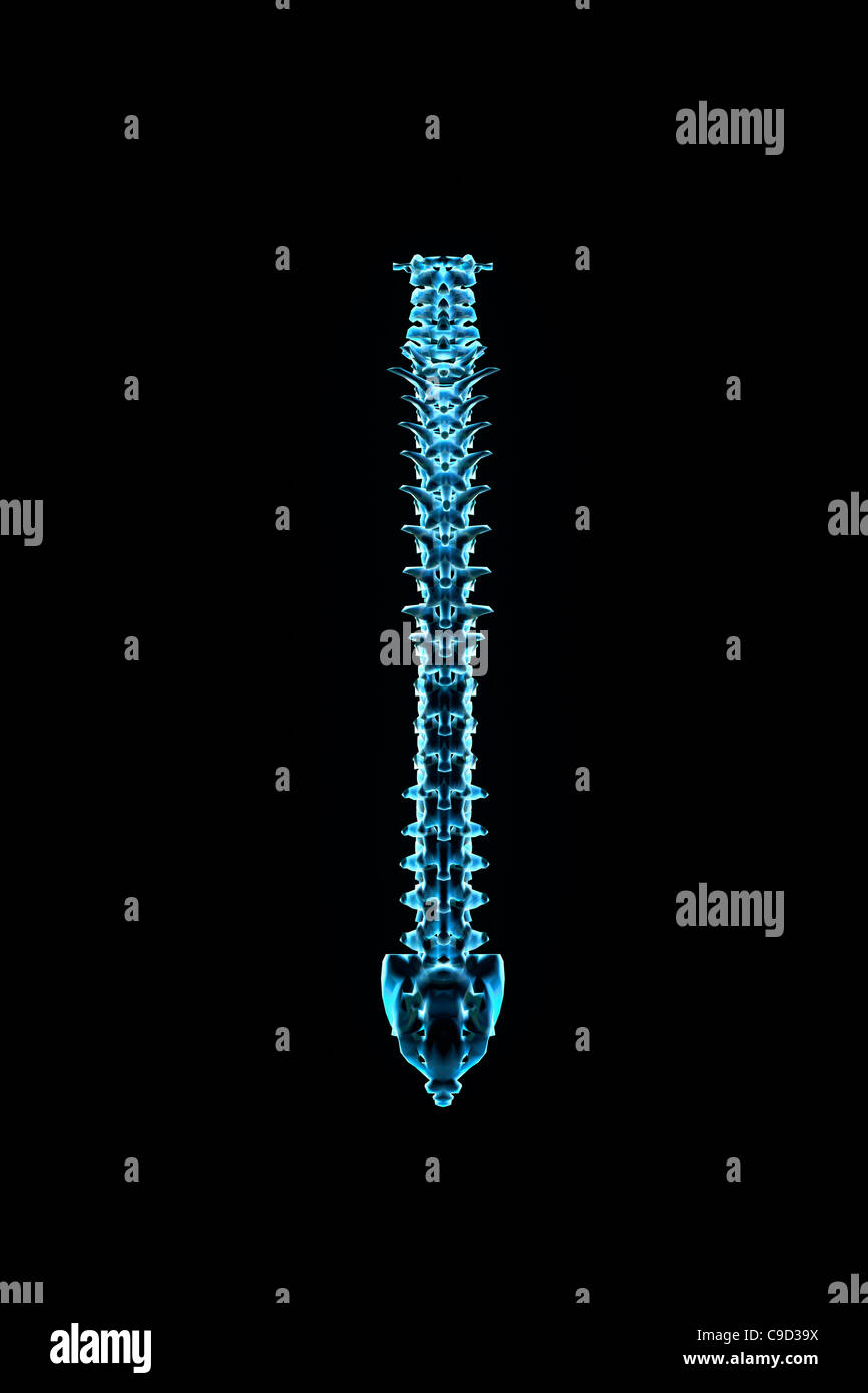 Male human spinal column from rear in blue X-ray by Hank Grebe Stock ...