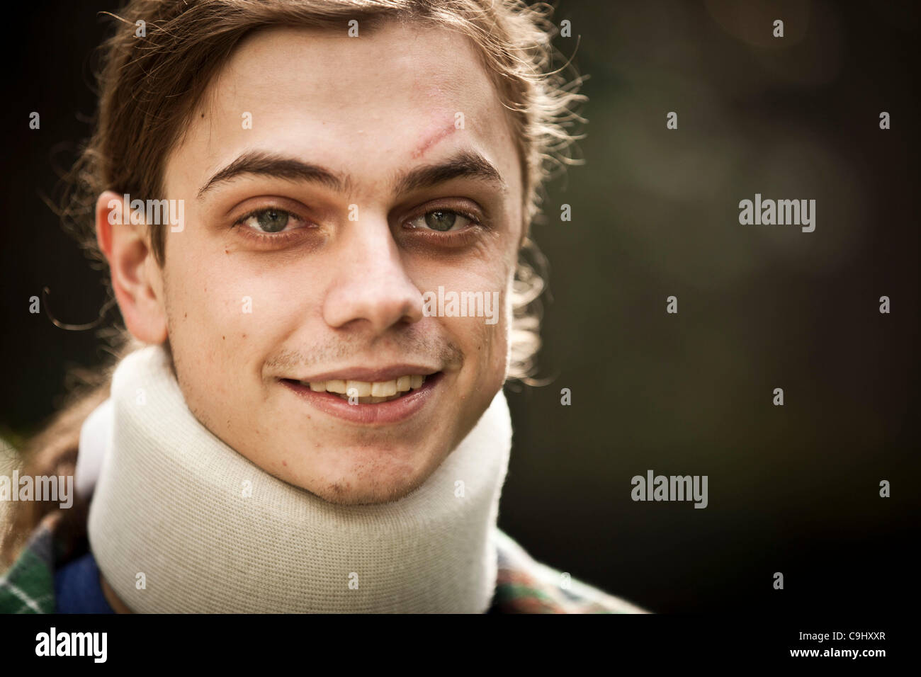 Scar above eye hi-res stock photography and images - Alamy