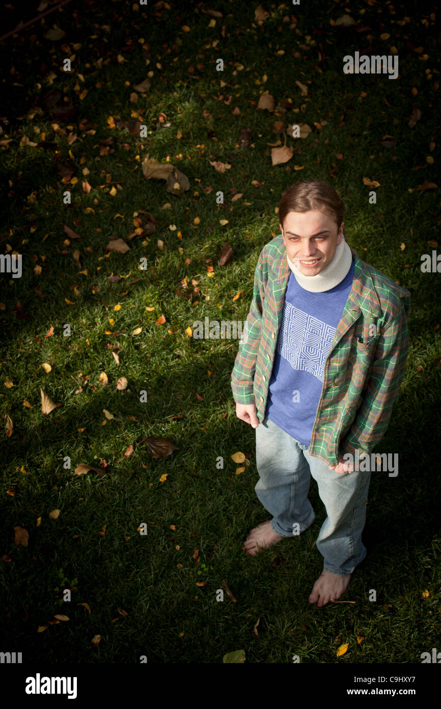 Scar above eye hi-res stock photography and images - Alamy