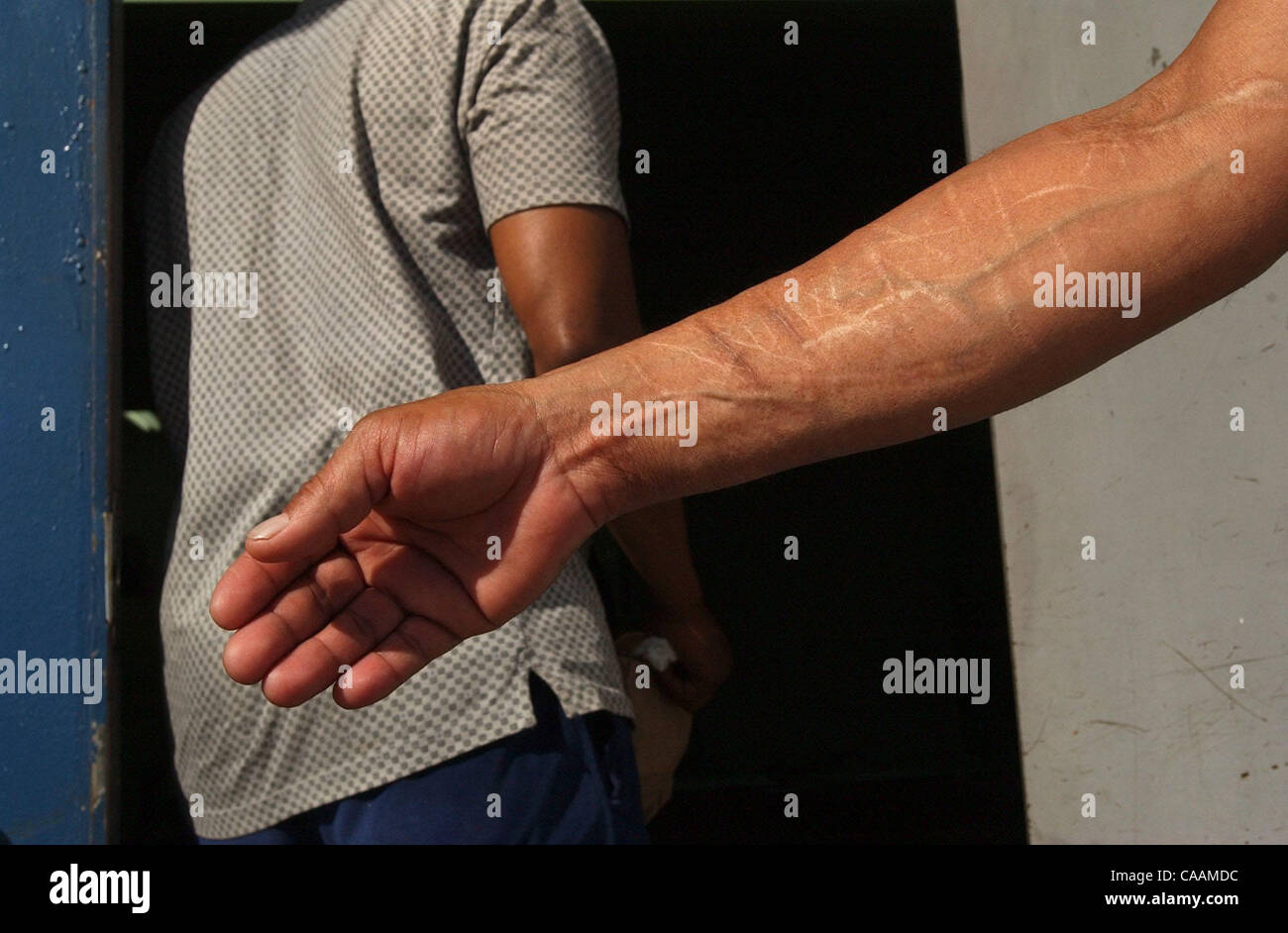 Mental wounds hi-res stock photography and images - Alamy