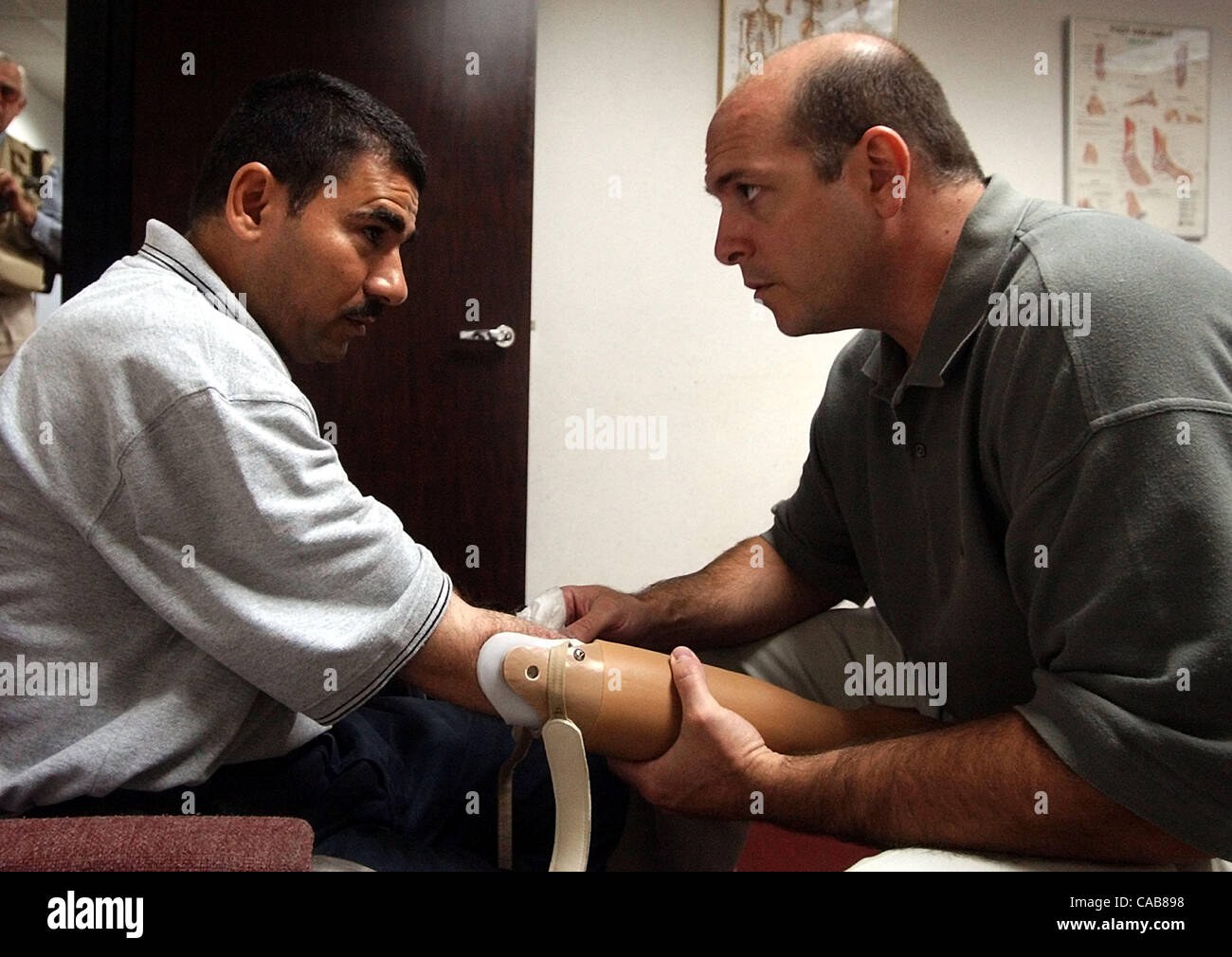 METRO - Orthotist David Baty fits Nazar Judi with his new prosthetic ...
