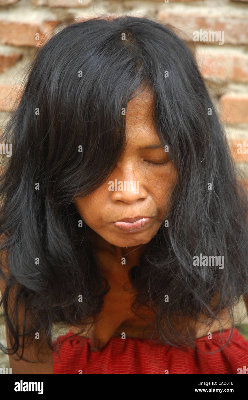 A patient at the Galuh foundation for people with mental health ...