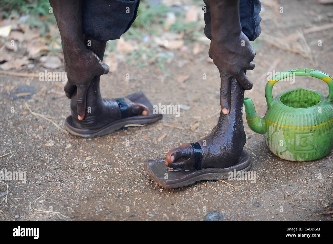 Inward feet hi-res stock photography and images - Alamy