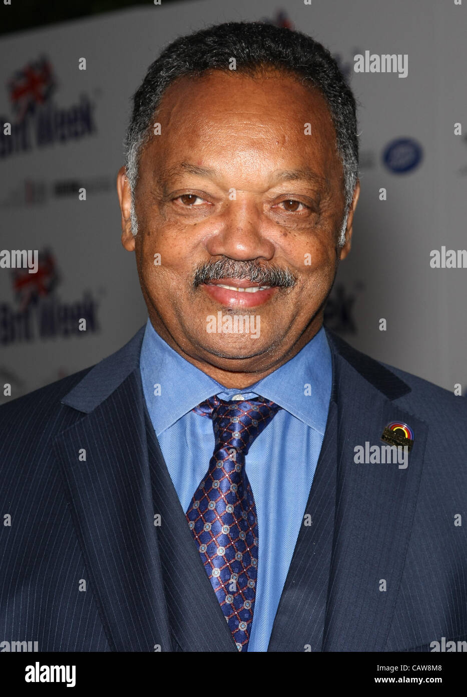 Jesse Jackson Cleft Lip