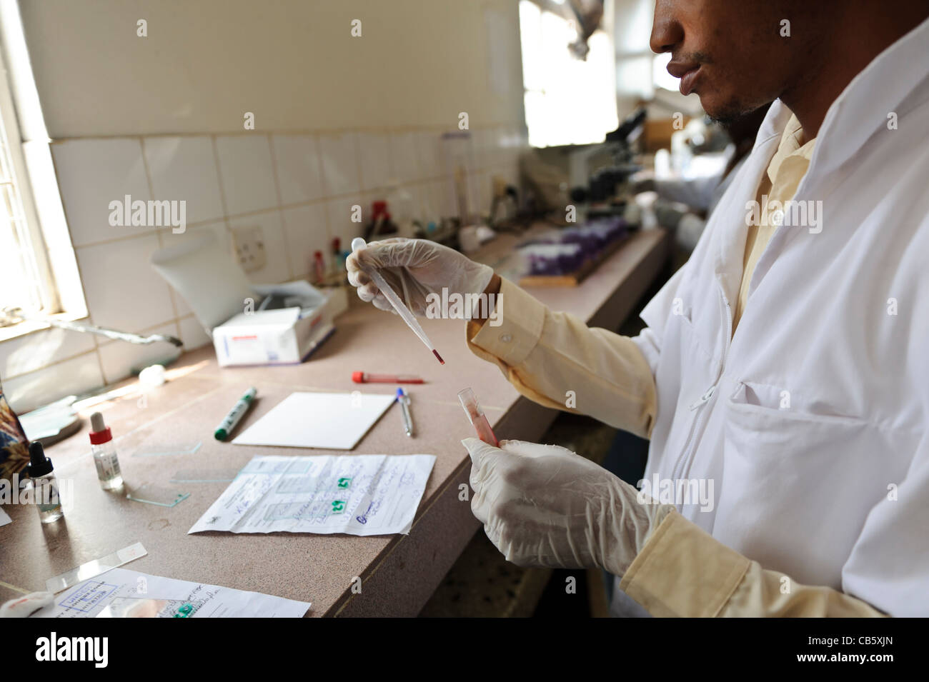 A laboratory technician in a hospital testing blood samples for Malaria ...