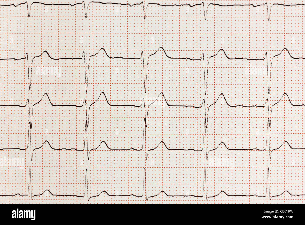 Electrocardiogram result print Stock Photo - Alamy