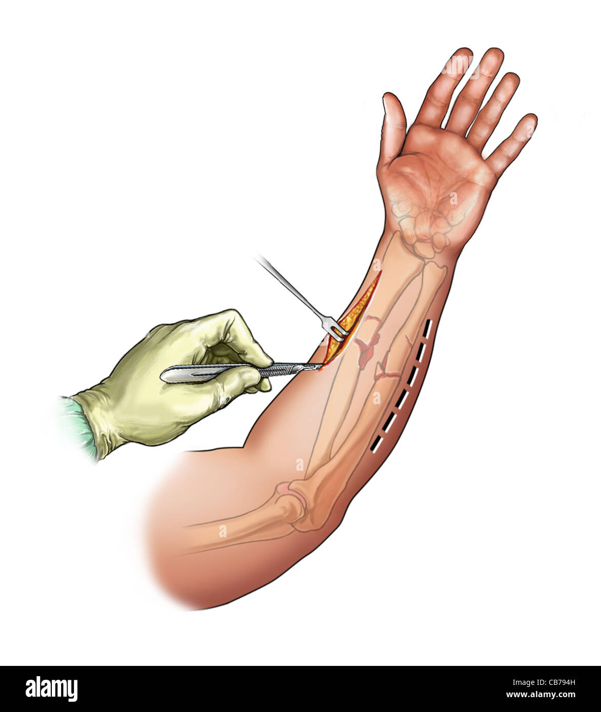 Radius ulna forearm hi-res stock photography and images - Alamy