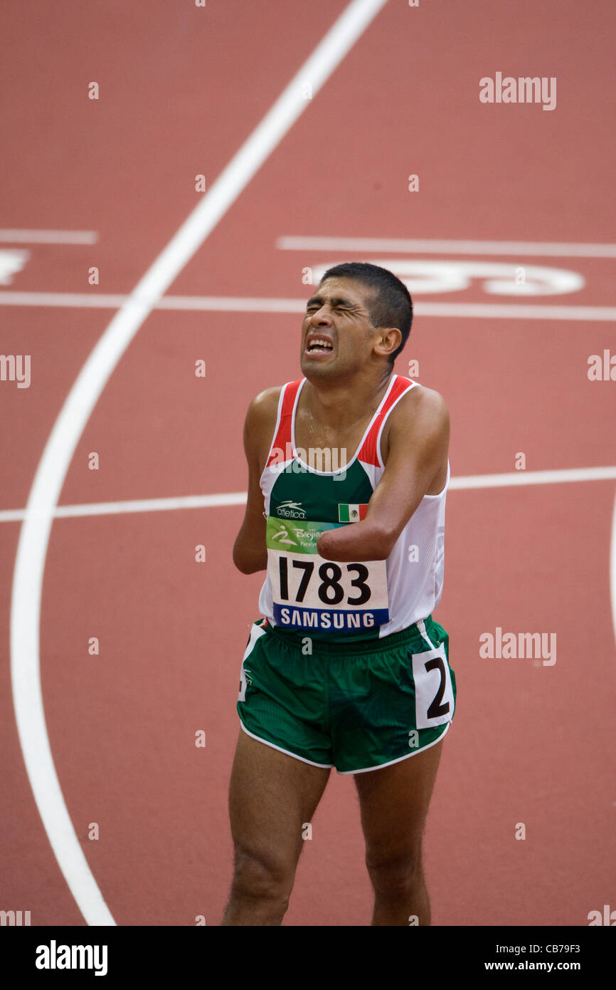 2008 Paralympic Games showing double hand amputee athlete from Mexico ...