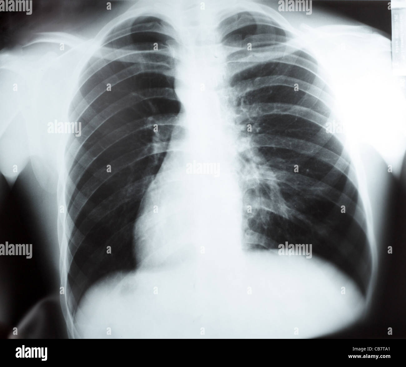 Chest anatomy hi-res stock photography and images - Alamy