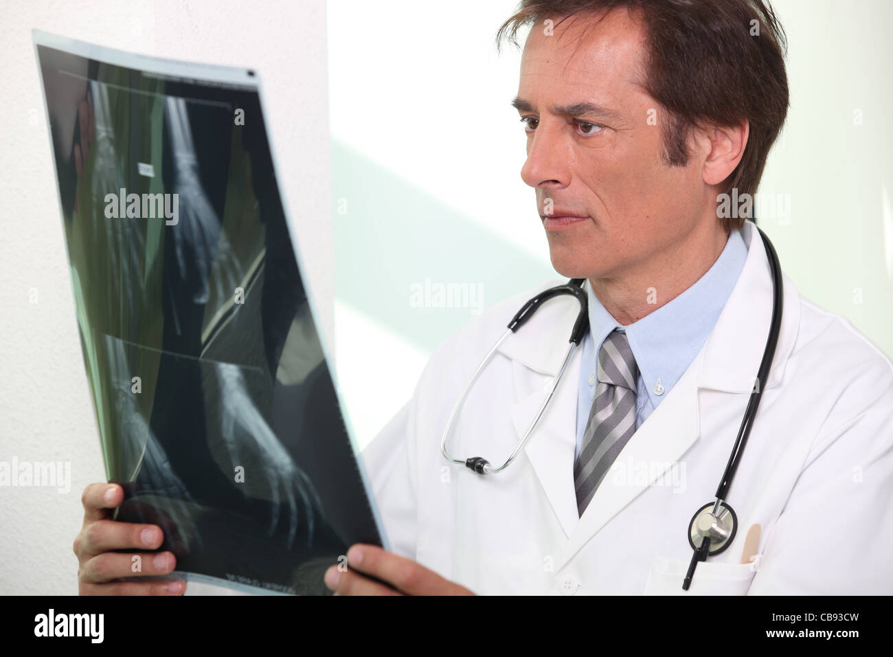 Doctor observing hand x-ray Stock Photo - Alamy
