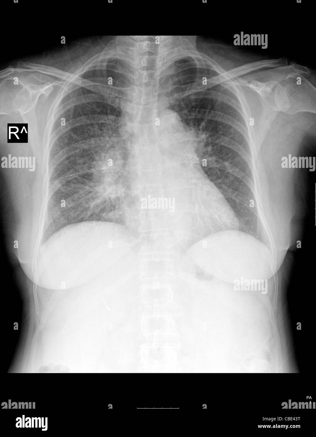 False ribs hi-res stock photography and images - Alamy