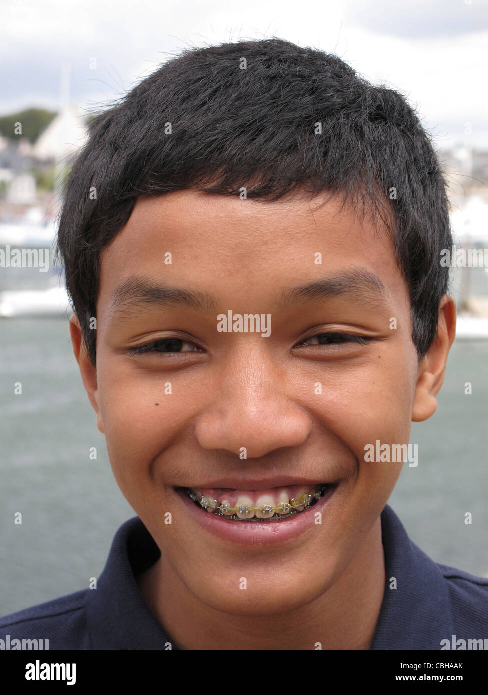 Boy with orthodontics braces hi-res stock photography and images - Alamy