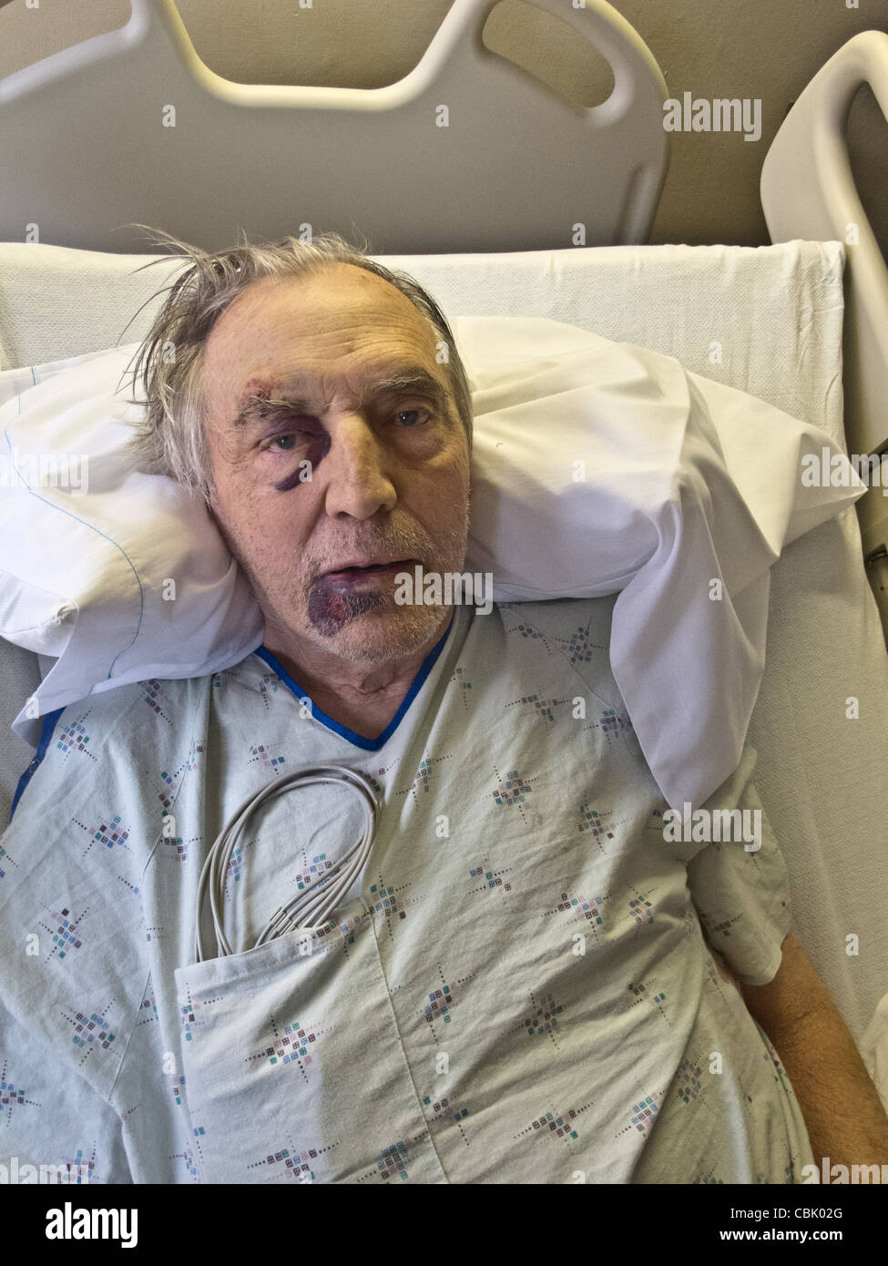 Elder Male Hospital Patient Stock Photo - Alamy