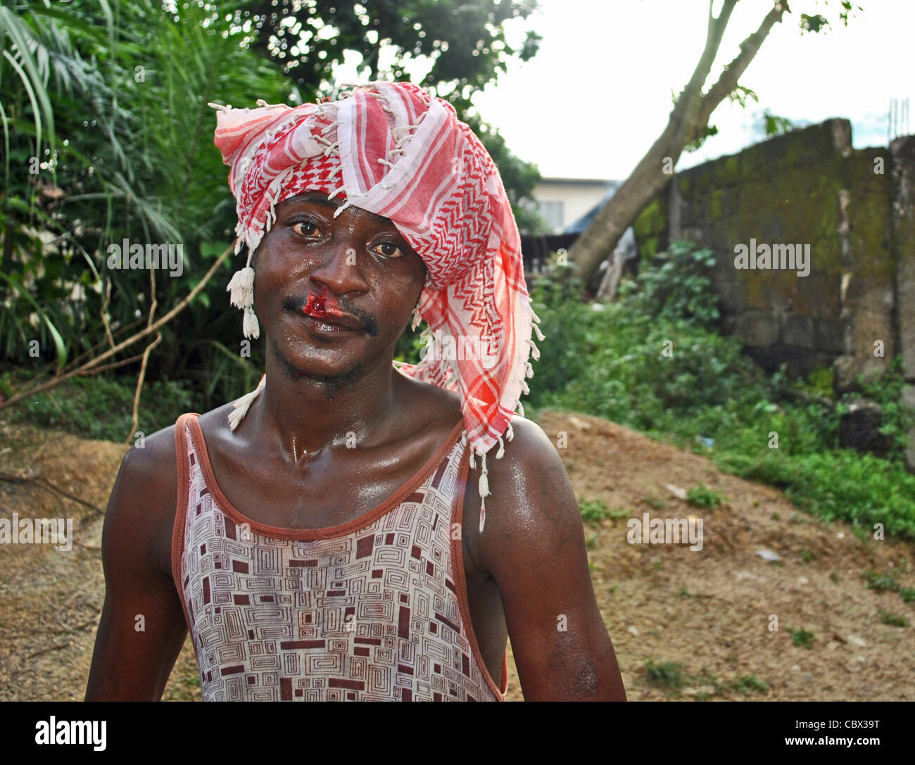 A man wounded in fighting between different political parties at an ...