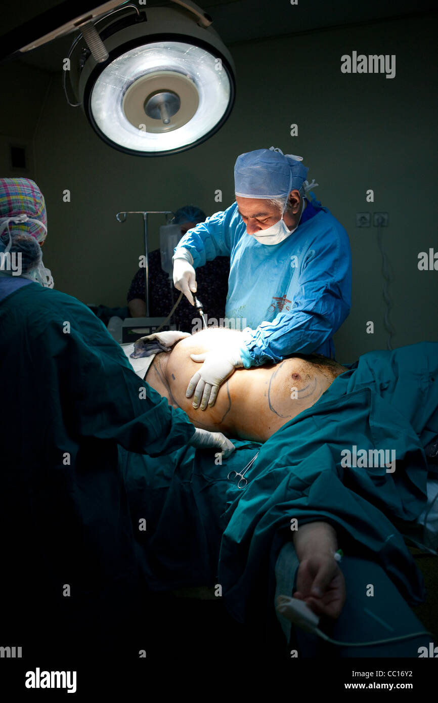 Liposuction cannula hi-res stock photography and images - Alamy