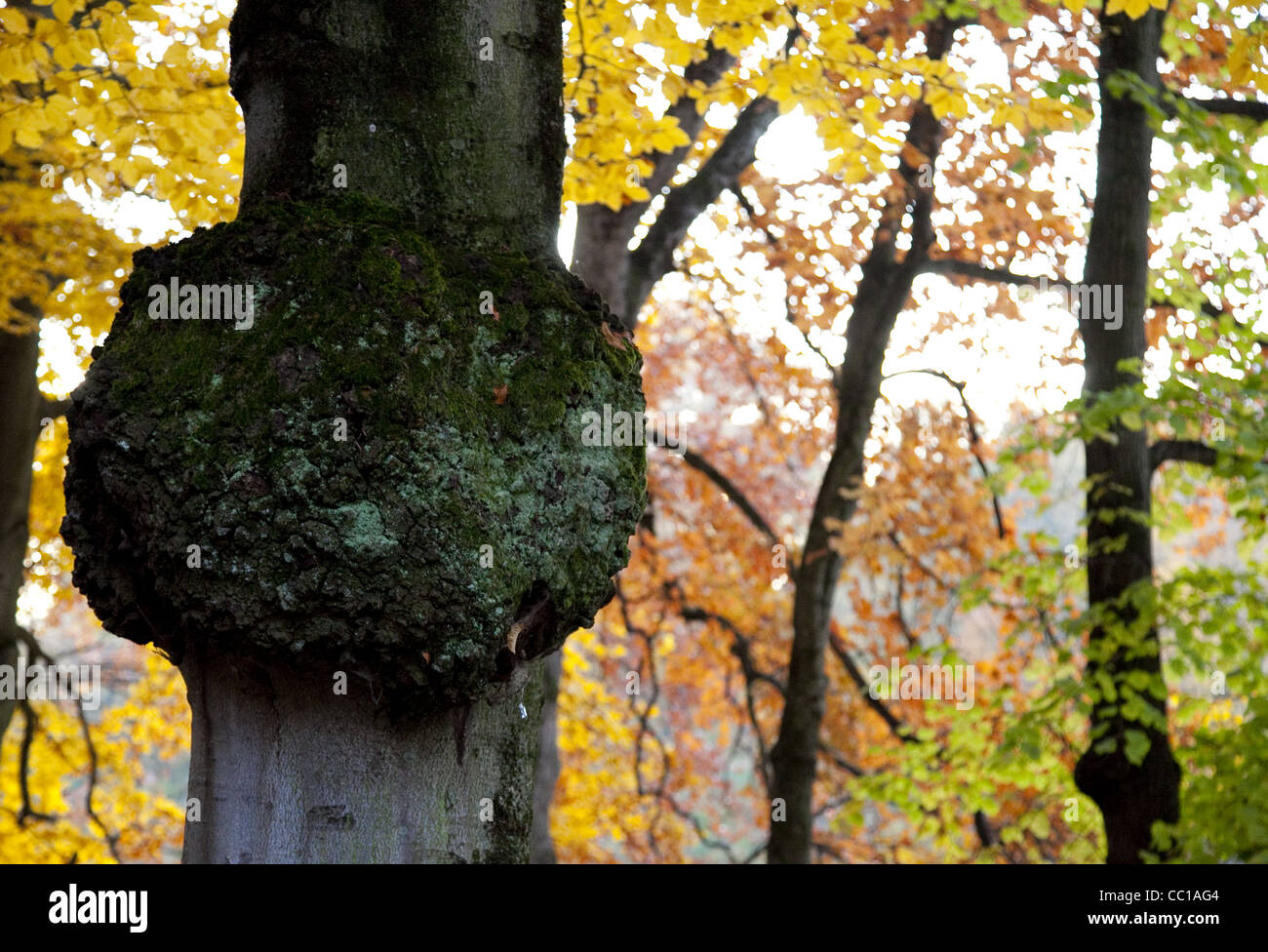 Tumour hi-res stock photography and images - Alamy